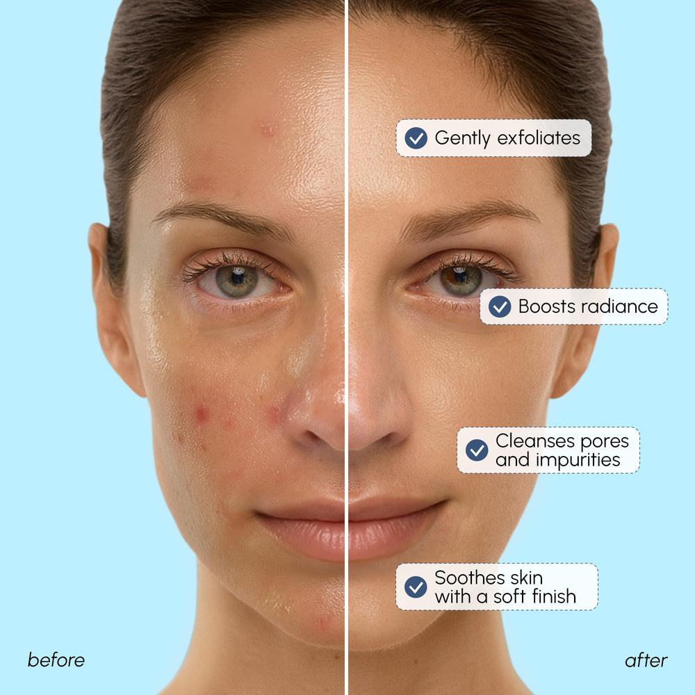 MAREE Face Exfoliator — Gentle Glycolic + Collagen Microdermabrasion S ...