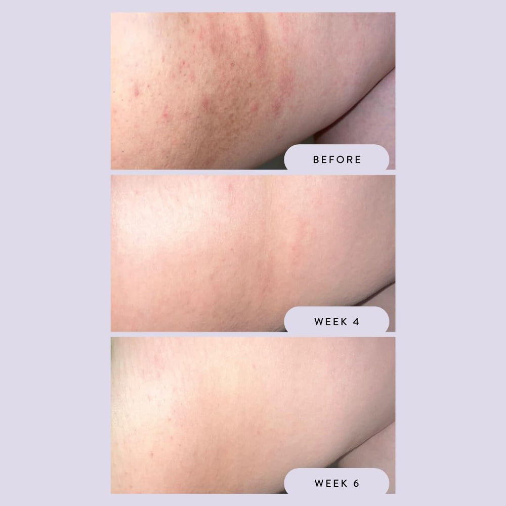 Megababe Night Rescue | Brightening & Soothing Night Cream | 2.12 oz ...